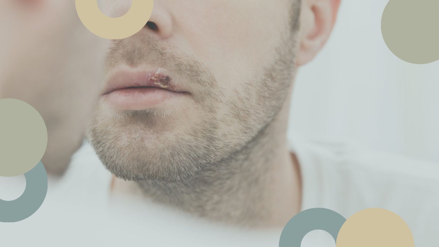 El Herpes Labial en la salud dental | Dr. S.SolÃ­s